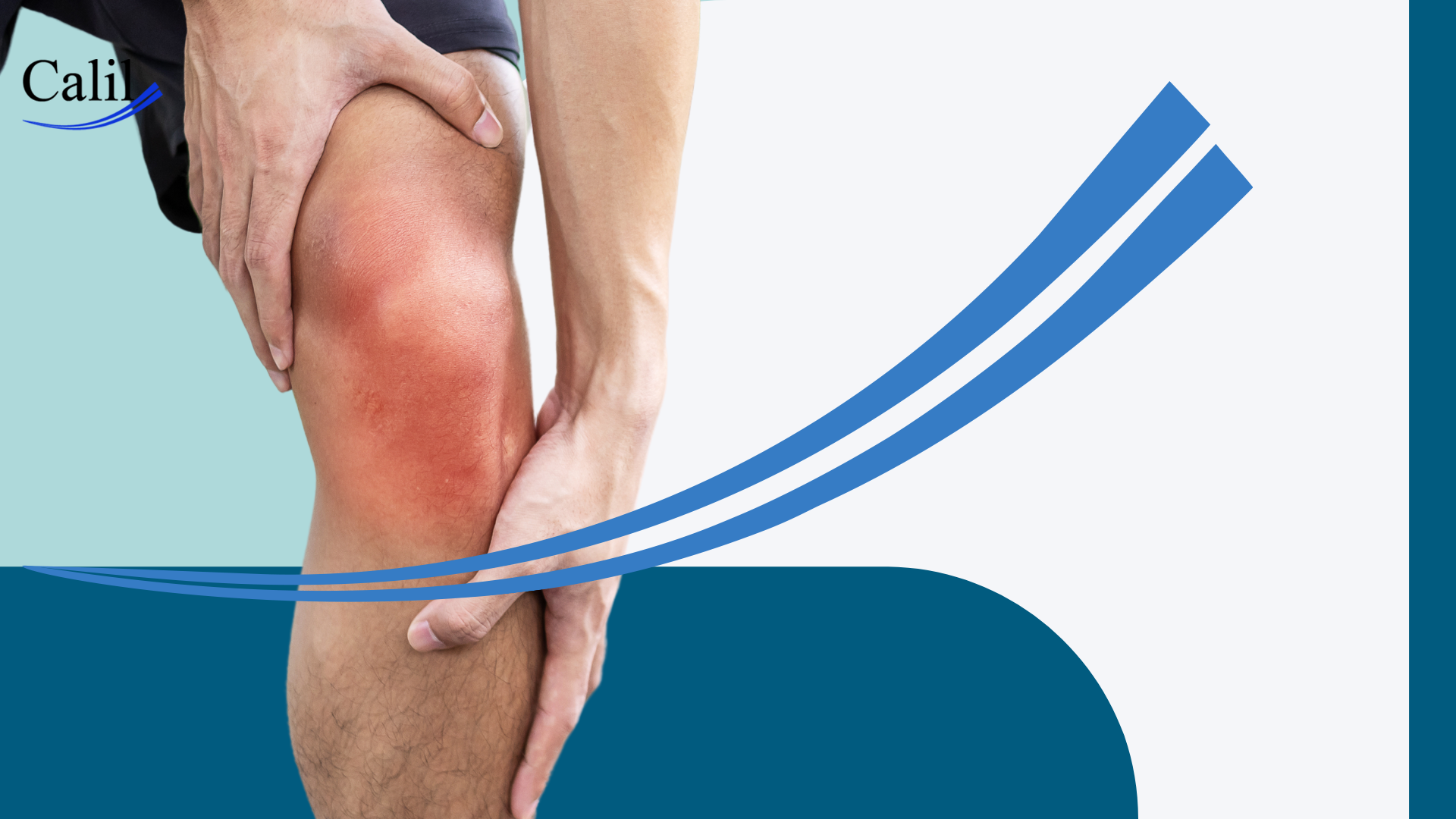 Dor patelofemoral: como evitar? - Dr Leandro Calil