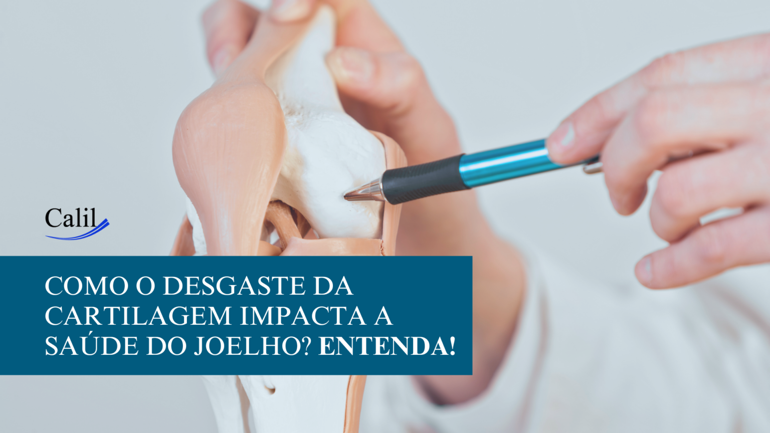 Gonartrose: entenda o que é, suas causas e principais tipos de ...