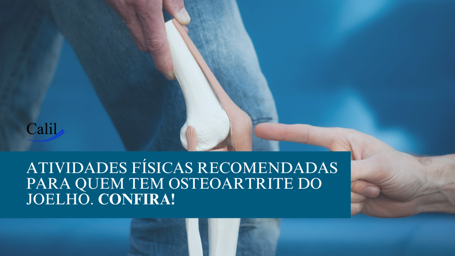 Gonartrose: entenda o que é, suas causas e principais tipos de ...