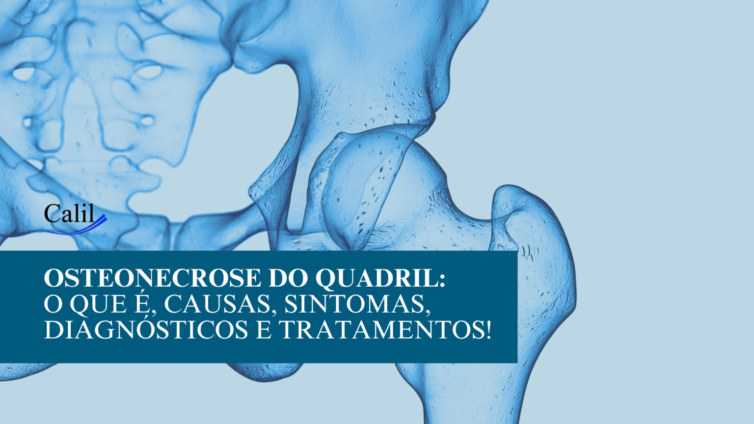 Necrose da cabeça femoral: o que é, sintomas, diagnóstico e principais ...